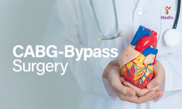 CABG-Bypass Surgery - MedEx