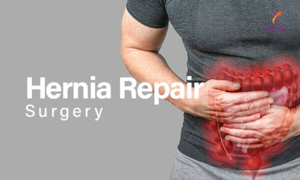 Hernia Repair Surgery - MedEx